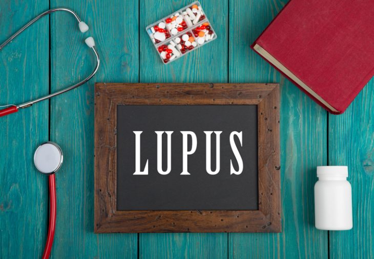 Lupus je autoimuna bolest, a ovo su najčešći simptomi