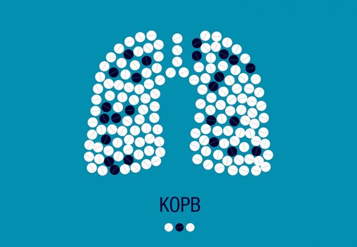Kronična opstruktivna plućna bolest: KOPB se može liječiti