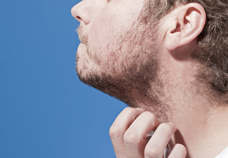 Zašto vas svrbi brada?