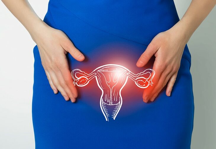 Upala jajnika i jajovoda: uzroci, simptomi i liječenje