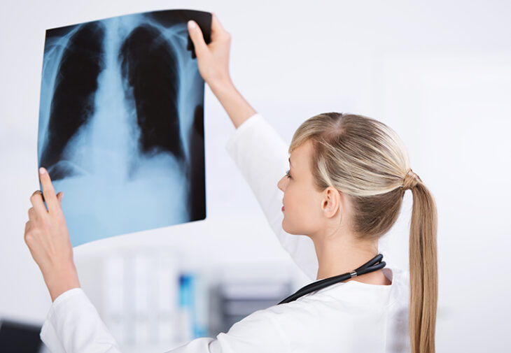 Nije svaka sjena na plućima karcinom