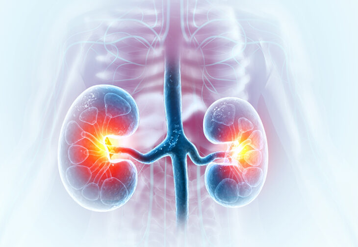 Svjetski dan bubrega – priprema za neočekivano, pomoć ranjivima