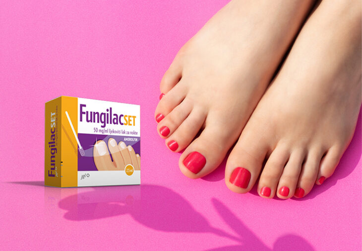 Gljivične infekcije noktiju: savjeti za njihovo sprječavanje i liječenje