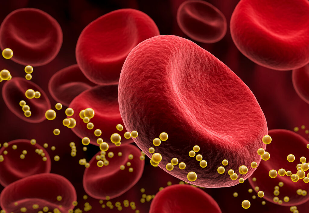 Kako smanjiti povišene masnoće u krvi i što treba znati o statinima